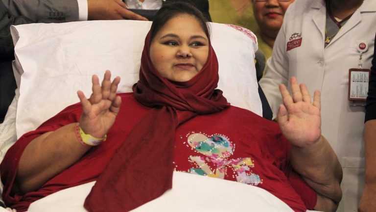 Egyptian Woman Who Was Considered 'Heaviest in the World' Passes Away ...