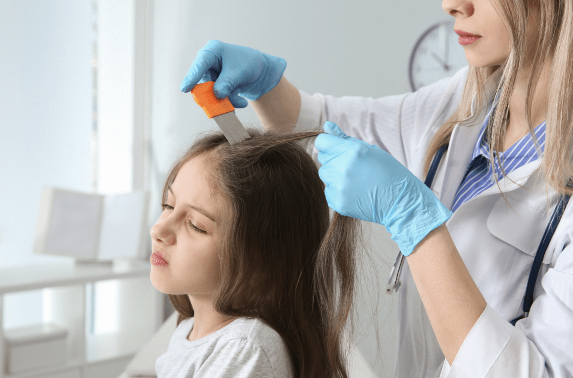 Busting Common Lice Myths: What You Need to Know - Scoop Empire